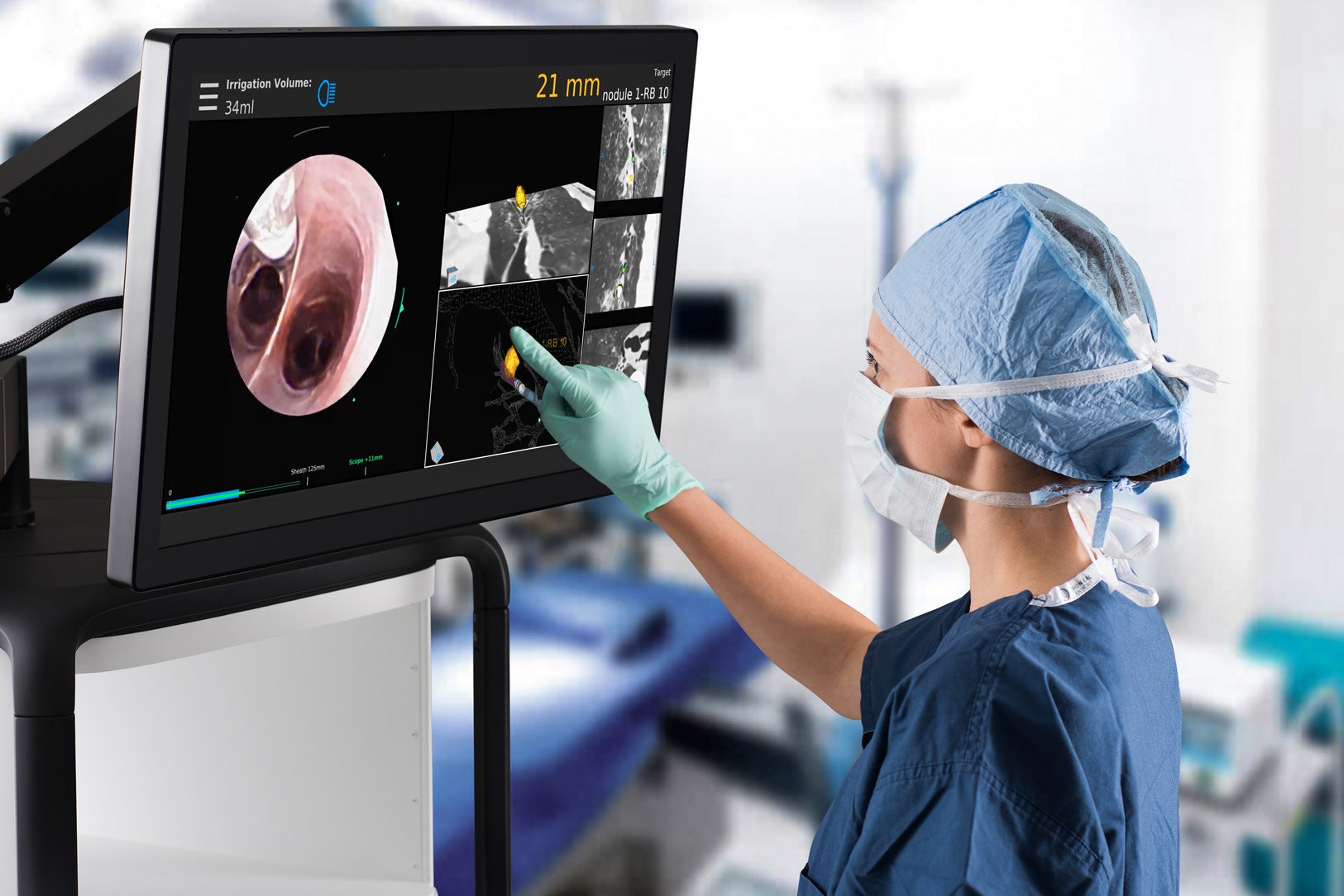 Robotic Bronchoscopy